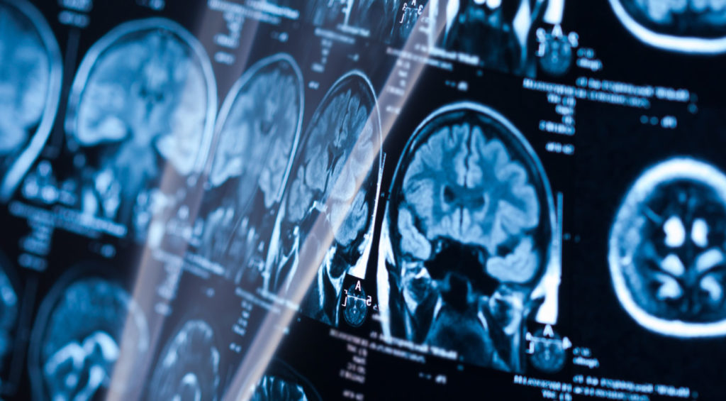 Best Online Master’s Programs in Biomedical Engineering - Master's ...